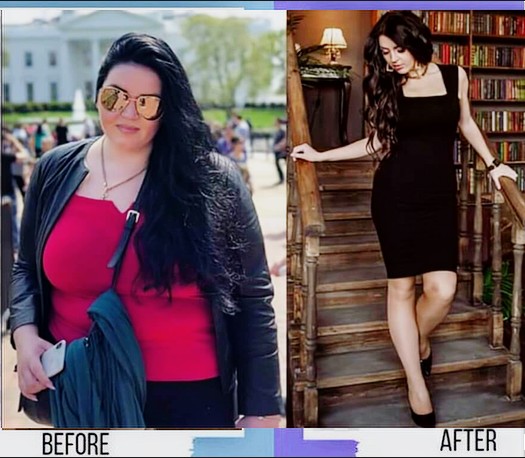 Mounjaro Tirzepatide Shots for Weight Loss in South Florida: Cost ...